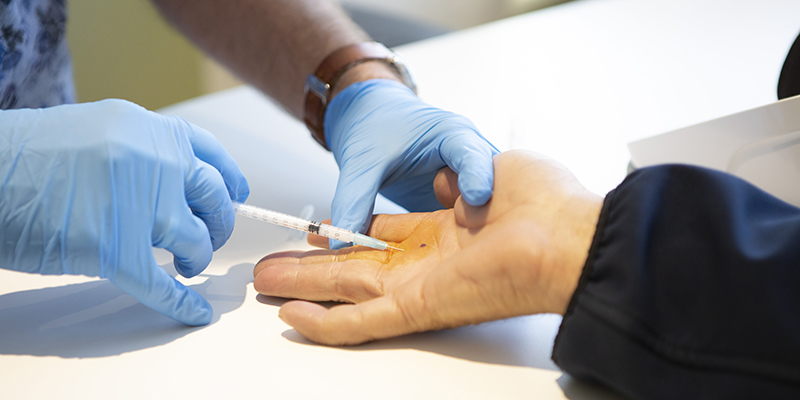 Slagingspercentage van injectie door huisarts voor behandeling triggerfinger is 60% | H&W